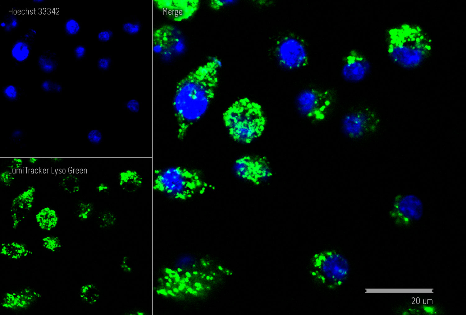 LumiTracker Lyso Green